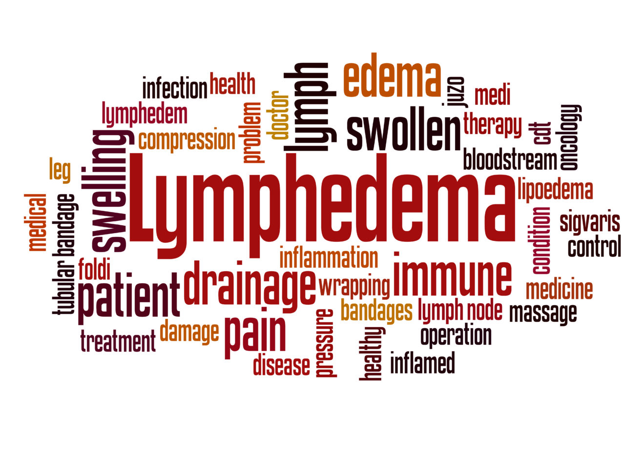 Learn More About Lymphedema - Compass Therapeutic, Inc.